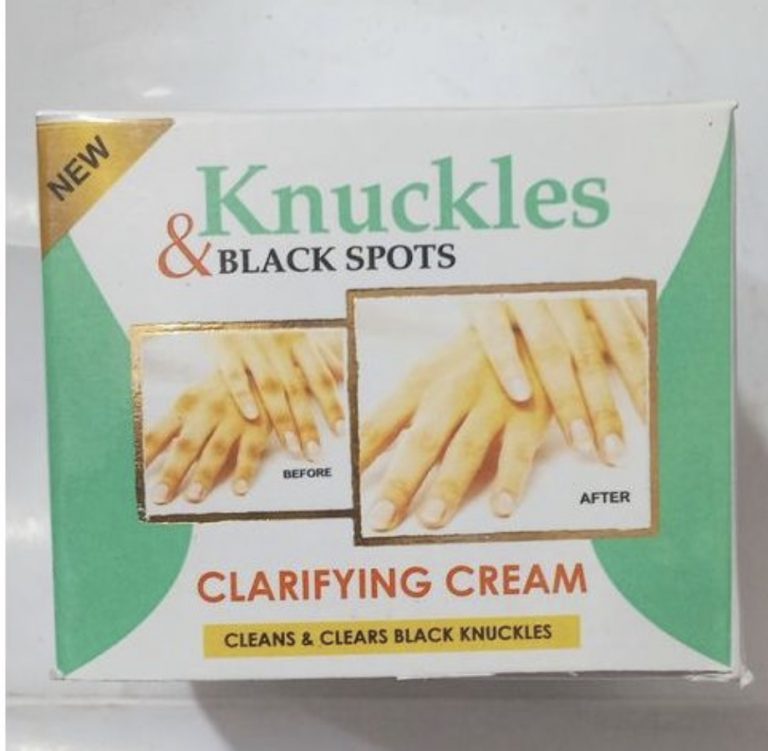 Skin Beauty Knuckles & Black Spots Remover- Very Effective - Skin Glow ...